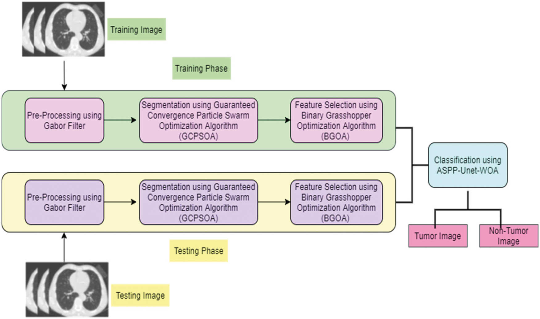 Detection of Lung Tumor Using ASPP-Unet with Whale Optimization Algorithm